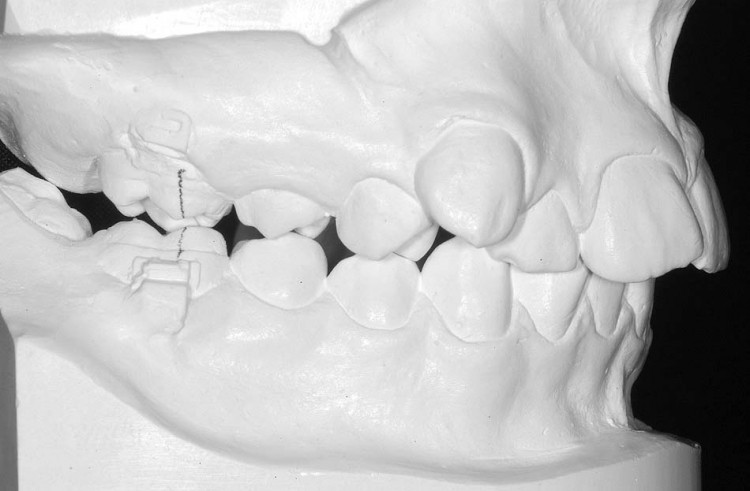 Gute Ergebnisse, geringerer Aufwand – ZWP online – das ...
