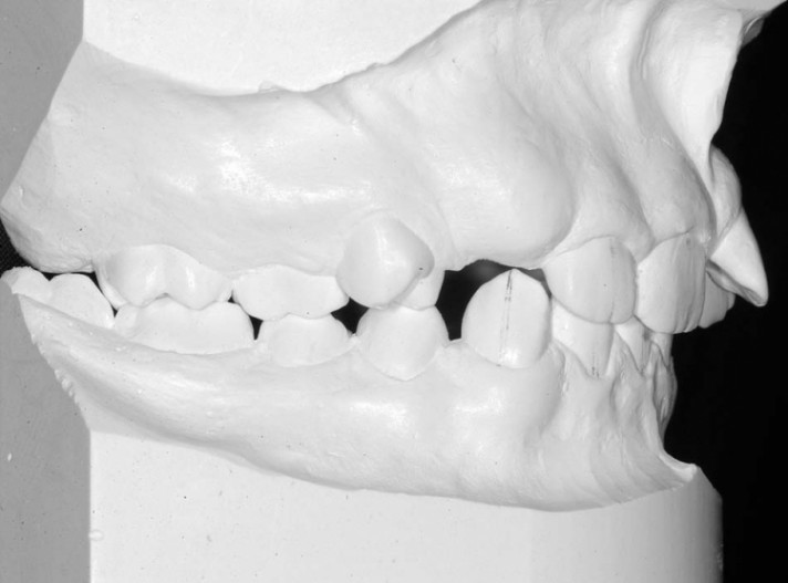 Gute Ergebnisse, geringerer Aufwand – ZWP online – das ...