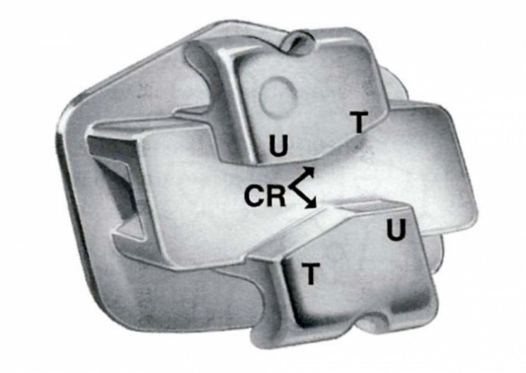Gute Ergebnisse, geringerer Aufwand – ZWP online – das ...