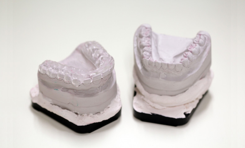 Legales Doping für den Kiefer? Einsetzen von Aufbissbehelf – ZWP online ...