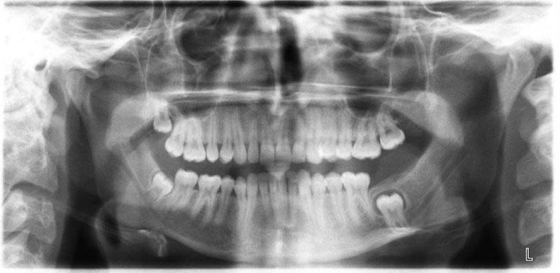 DVT oder konventionelle Röntgendiagnostik?! – ZWP online – das ...