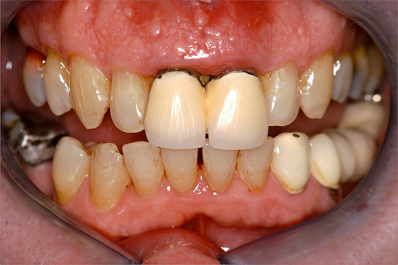 Prävention oraler Leiden bei schweren Allgemeinerkrankungen – ZWP ...