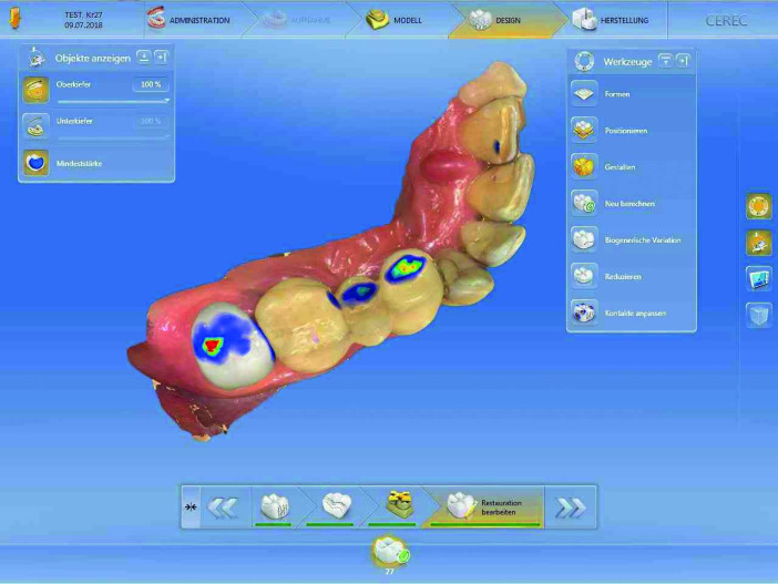 Digitaler Workflow – ­ einfach und zeitsparend – ZWP online – das Nachrichtenportal für die ...