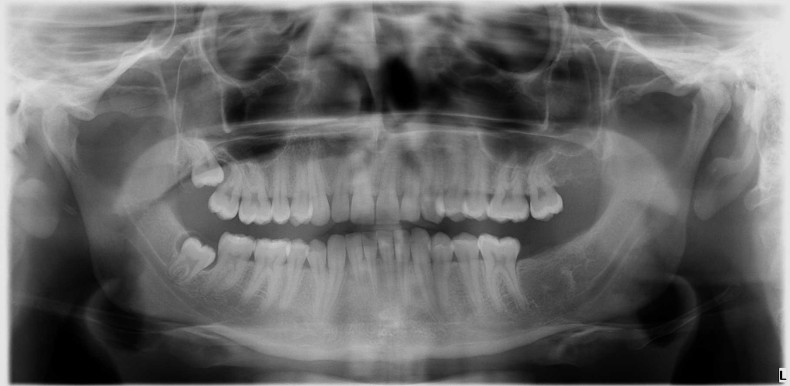 DVT oder konventionelle Röntgendiagnostik?! – ZWP online – das ...