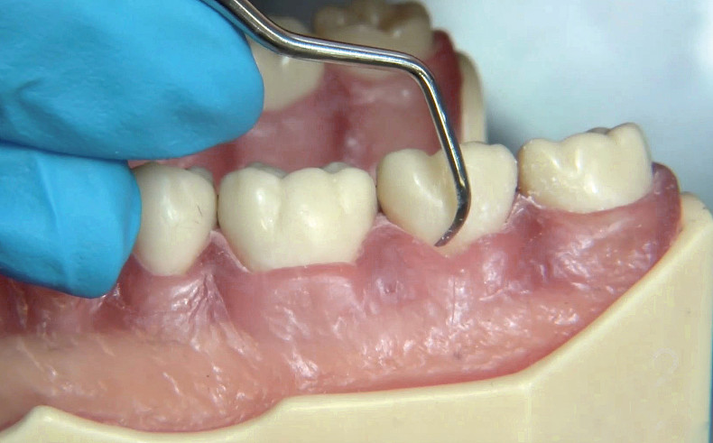 Instrumentationstechniken bei PMPR und UPT – ZWP online – das ...