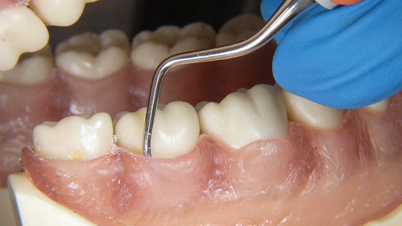 Instrumentationstechniken bei PMPR und UPT – ZWP online – das ...