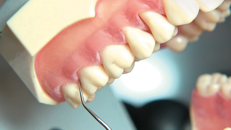 Instrumentationstechniken bei PMPR und UPT – ZWP online – das ...