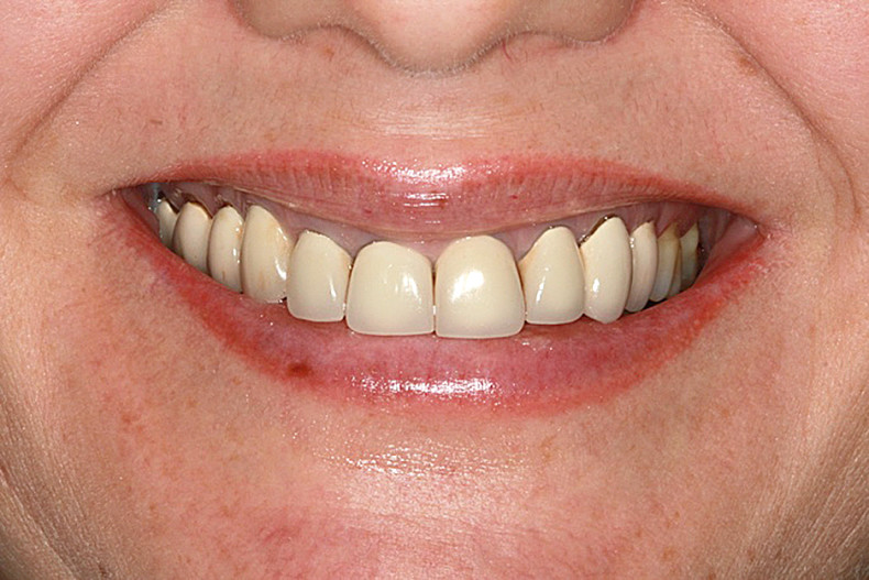 Die Architektur des Lächelns – Vision, Planung und Umsetzung – ZWP ...