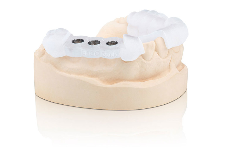 BEGO Guide Starterpaket – Einfach.Sicher.Implantieren. – ZWP online ...