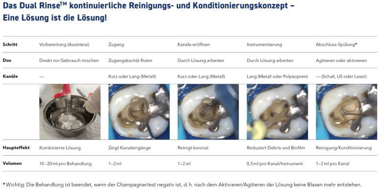 HEDP in der Endodontie – Neue Wege in der Wurzelkanaldesinfektion – ZWP ...