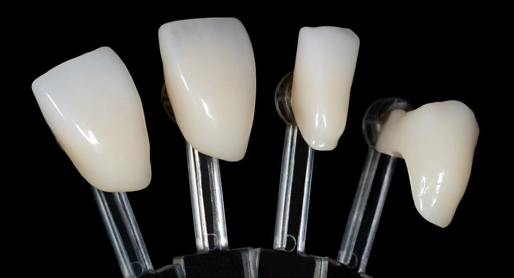 Zirkonzahn Shade Guide – ZWP online – das Nachrichtenportal für die ...