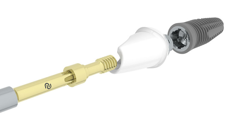 Flexident: Innovative Schulung zum digitalen Workflow – ZWP online ...