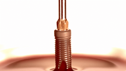 Neoss GmbH – ZWP online – das Nachrichtenportal für die Dentalbranche